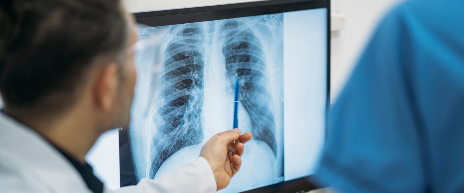Lung Health Checks - Cwm Taf Morgannwg University Health Board